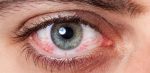 Picaturile de ochi – cand si cum se folosesc – Sfaturimedicale.ro