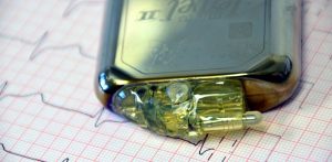 Stimulator cardiac – tot ce trebuie sa stii – Sfaturimedicale.ro