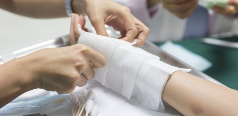 Arsuri – cauze si tehnici de prim ajutor – Sfaturimedicale.ro