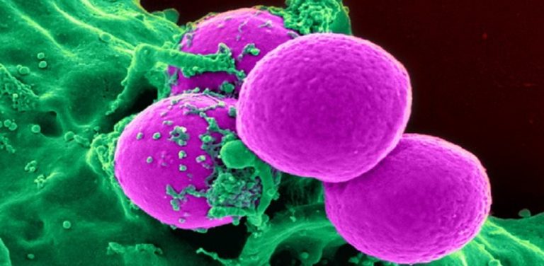 Stafilococul auriu si alte infectii stafilococice – simptome si ...