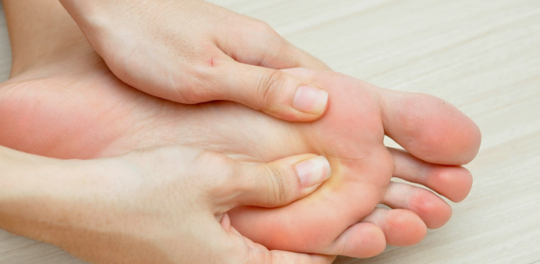 Fasceita plantara – cauze, simptome, tratament – Sfaturimedicale.ro