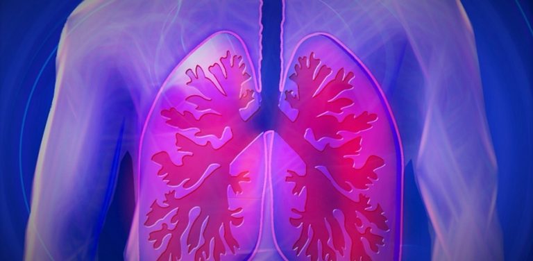 BPOC – boala pulmonara obstructiva cronica – simptome si tratament ...