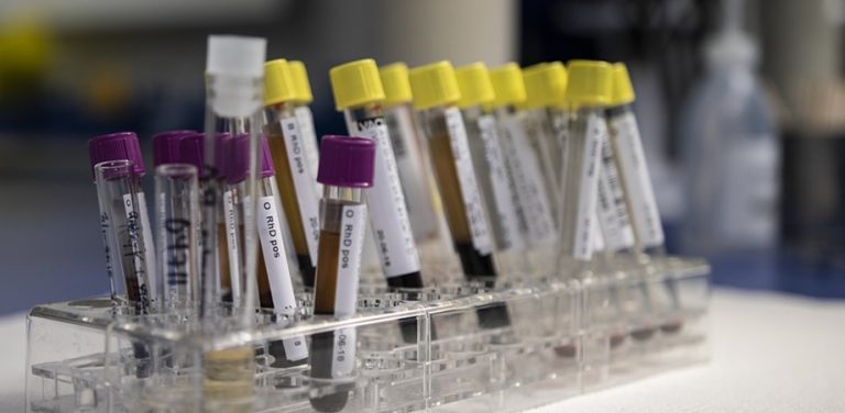 Sideremia – indicatii si interpretare rezultate – Sfaturimedicale.ro