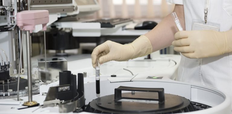 VSH marit – ce inseamna si care sunt simptomele – Sfaturimedicale.ro