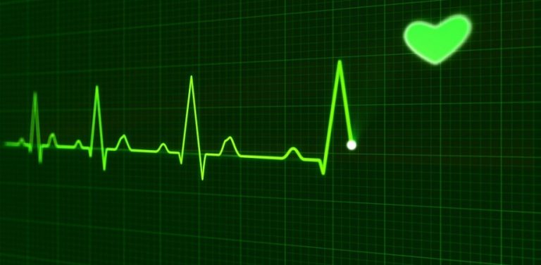Electrocardiograma (EKG) – tot ce trebuie sa stii – Sfaturimedicale.ro