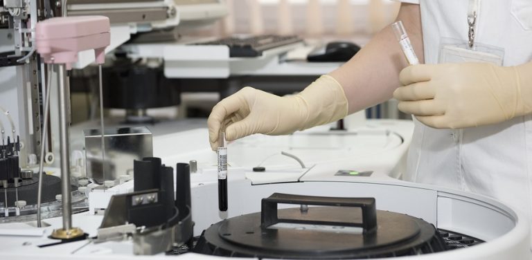 Siclemia – cauze, simptome, remedii eficiente – Sfaturimedicale.ro