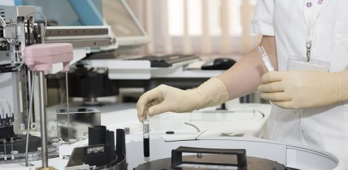 Sindromul Gilbert – simptome, cauze, tratament – Sfaturimedicale.ro