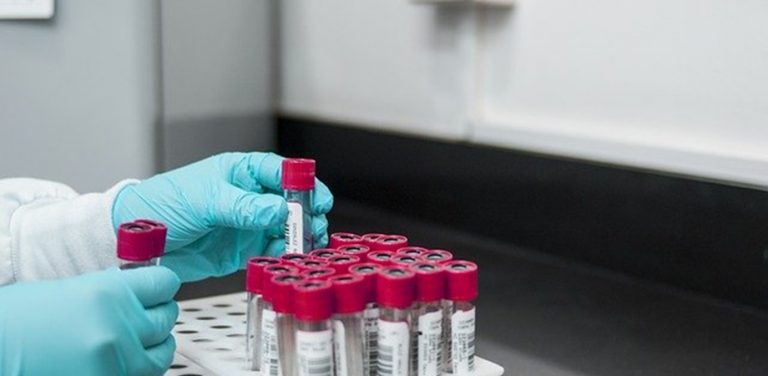 Testul hemocult (testul pentru hemoragii oculte in fecale ...