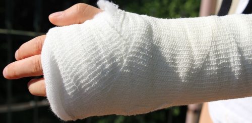 Fractura in lemn verde – cauze, simptome, tratament – Sfaturimedicale.ro