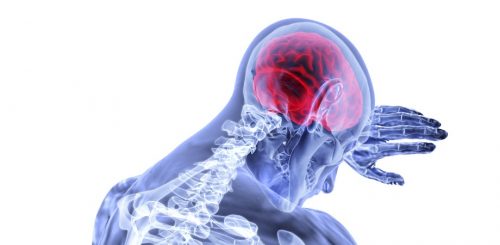 Recuperarea dupa AVC – tot ce trebuie sa stii – Sfaturimedicale.ro